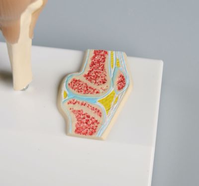 Articulaţia genunchiului în miniatură cu secţiune transversală – ANATOMIKA