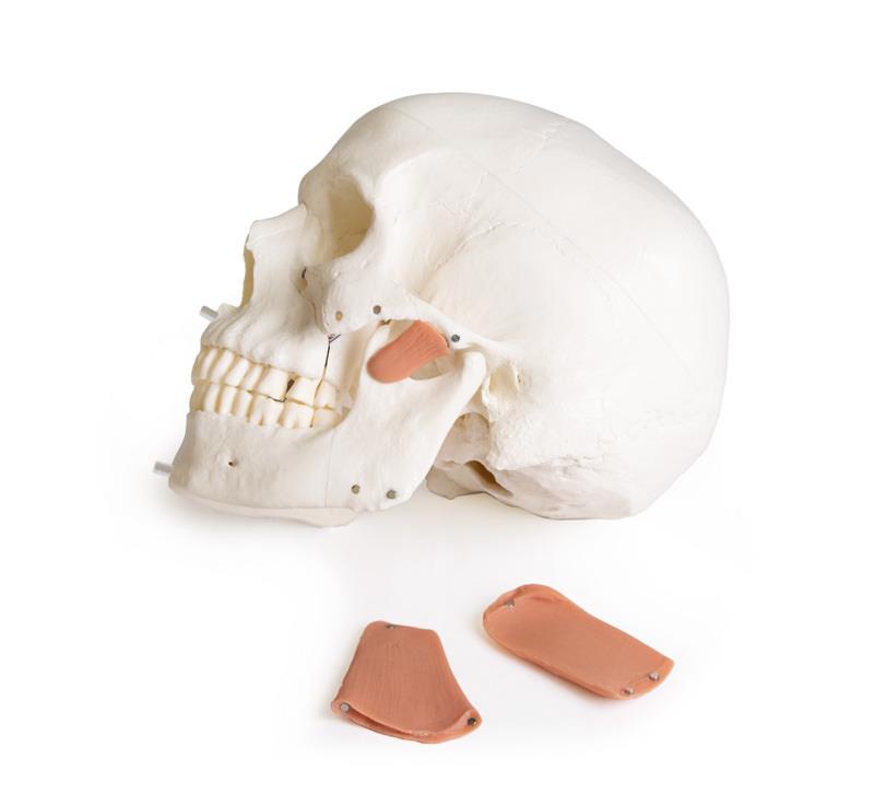 Model de craniu pentru stomatologie cu sindrom TMD, 8 piese – ANATOMIKA