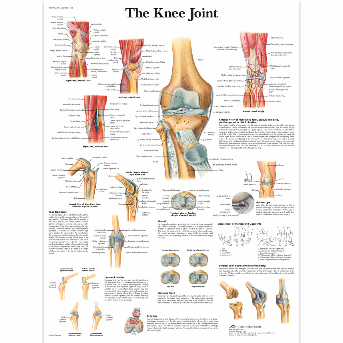 Poster "Articulatia genunchiului" - 3B Scientific – ANATOMIKA