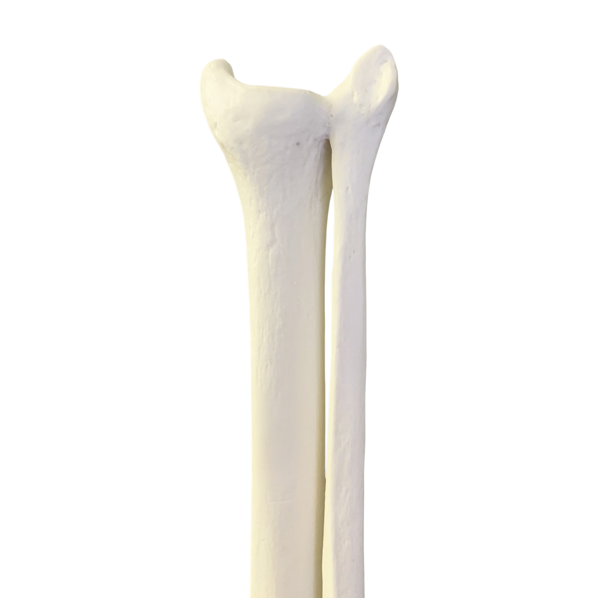 Tibie şi peroneu parte stângă – ANATOMIKA